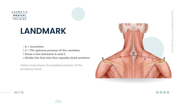 Trap Tox; Botox Injection Technique Into the Trapezius Muscles